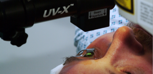 Crosslinking Corneal – Centro de Diagnóstico Ocular Cirugía Laser